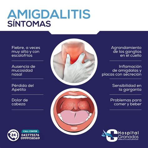 La Amigdalitis Es Una Enfermedad Hospital Granados