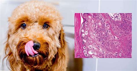 Successful Treatment Of Persistent Oral Papilloma Using Co2 Laser Therapy