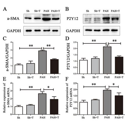Pdf The P2y12 Receptor Antagonist Ticagrelor Ameliorates Pulmonary