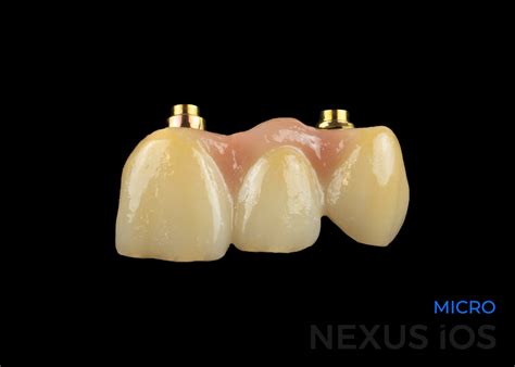 Nexus Micro — Nexus Ios