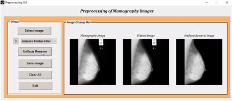 Matlab Projects Of Digital Image Processing Audio Processing Video