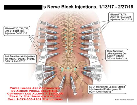 Medical Exhibits Demonstrative Aids Illustrations And Models