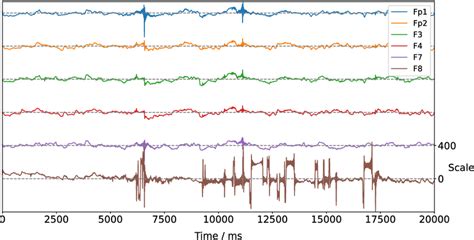 An Example Of The Coma EEG Signals With High Amplitude Noise Download Scientific Diagram