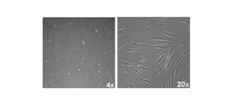 Fibroblast Cell Markers Research Areas Novus Biologicals
