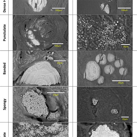 Sem Images Showing Two Examples Typical Of The Five Proposed Morphology Download Scientific