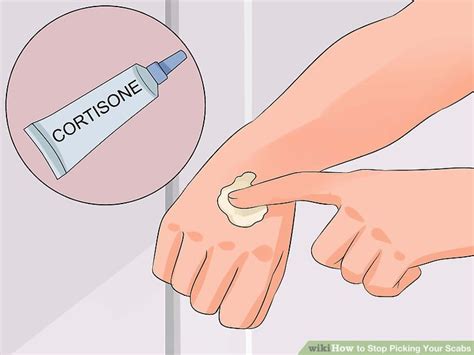 Ways To Stop Picking Your Scabs WikiHow