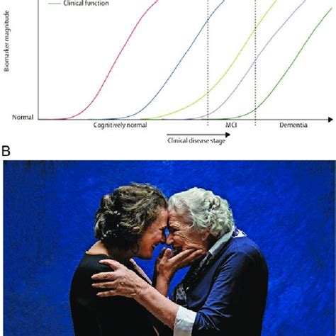 A Reprinted With Permission Of The Copyright Owner The Amyloid Download Scientific Diagram