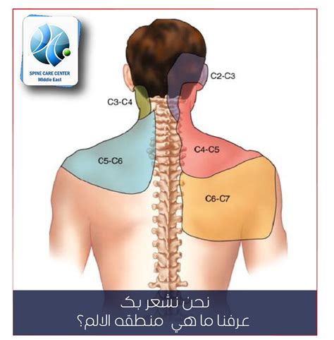 تابع معنا ثريد آلامالرقبة آلام الرقبة من الشكاوى الأكثر شيوعا هذه