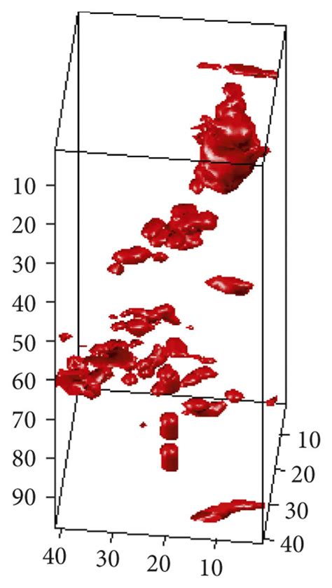 3d Tumor Segmentation Results Of Case 2 Obtained With Different