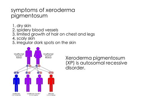 Xeroderma Pigmentosum Screen 2 On Flowvella Presentation Software