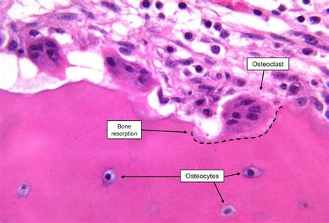 Spongy Bone Histology Slide Labeled