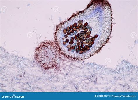 Inside Microscope View At Histology Glass Slide Royalty Free Stock