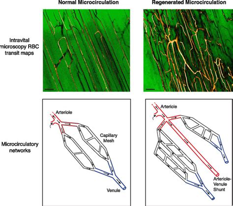 Regenerated Microvascular Networks In Ischemic Skeletal Muscle Pmc