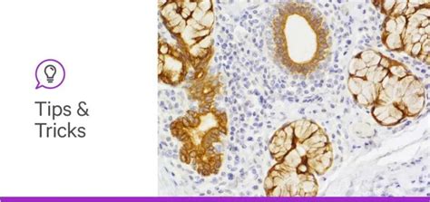 Unmasking Epitopes Using Antigen Retrieval For Formalin Fixed Tissue Staining Vectorlabs