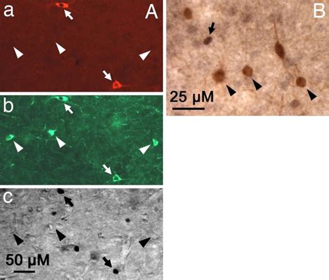 Immunohistochemical Characterization Of Sleep Active Nnos Ir Cells A