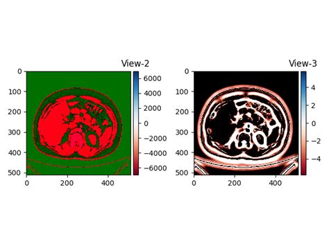 Github Yakeshkarthikey Functional Mri Tumor Detection Using Hybrid Deep Learnig Model A