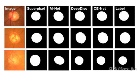 Ce Net Context Encoder Network For 2d Medical Image Segmentationgu 等人于2019年提出一种上下文编码网络ce Net