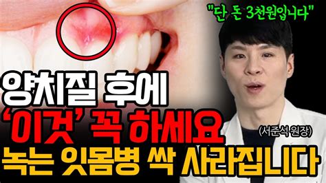 치과의사 꿀팁 대공개 치실 양치질 아닙니다 양치 후 이것 먼저 하면 잇몸병 사라지고 잇몸도 튼튼해집니다 서준석 원장 2부 Youtube