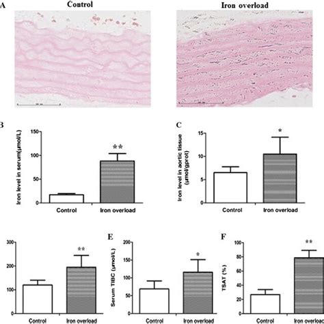 Expression Of Factors Related To Calcification In Aortic Tissue Of Iron