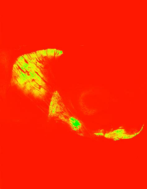 Gallery Brain Wire Behavior