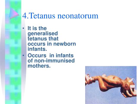 Ppt Tetanus Powerpoint Presentation Free Download Id9443387