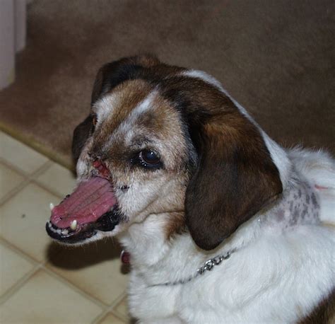 Maxillectomy Radical — Dr Julius Liptak