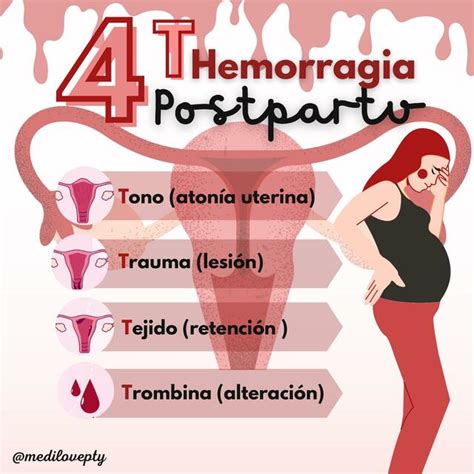 Hemorragia Postparto Medilove Udocz