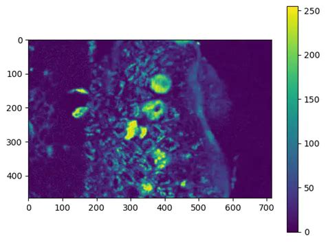 Image Data With Numpy And Matplotlib Ibots Learning Platform