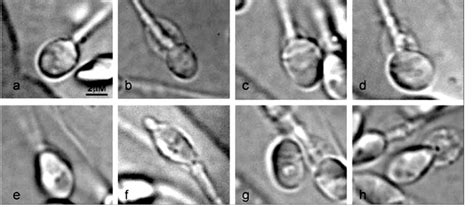 Micrographs Of Sperm With Nuclear Abnormalities Berkovitz Et Al