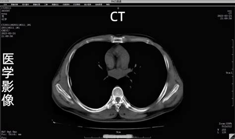 医院信息化pacs系统源码（影像阅片、报告模板、三维重建） 知乎