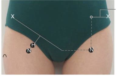 HMI105 WRITTEN TEST Flashcards Quizlet