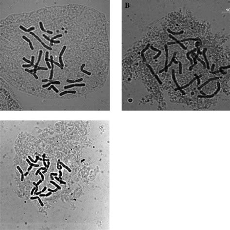 Photomicrographs Of Chromosome Spreads From Root Tip Squashes Of