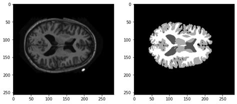 Github Karla Sam Brain Segmentation This Repository Contains The Code For Segmenting Brain