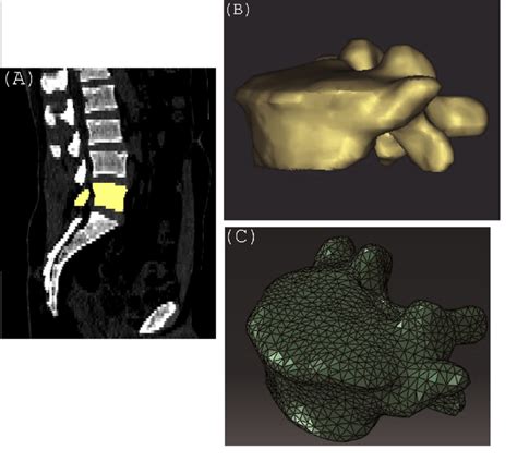Workflow To Obtain Finite Element Model Of L5 Vertebra A Segmented