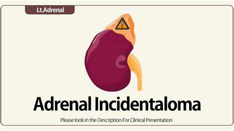 Linear Eus Adrenal Incidentaloma Youtube