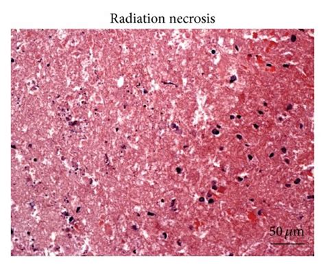 Formalin Fixed Paraffin Embedded Tissue Sections Stained With Download Scientific Diagram