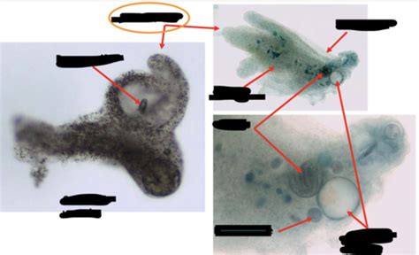 Lab Protozoa And Porifera Flashcards Quizlet