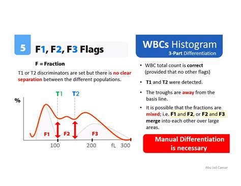 Wbc Histogram Pdf