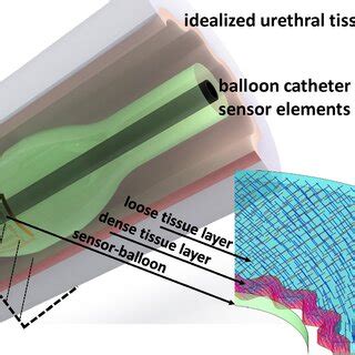 Schematic Showing The Motivation Of The Conducted FEA Study Download Scientific Diagram