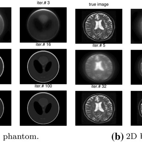 Poisson Imaging Reconstruction Mid Slices Of Recovery Images From The