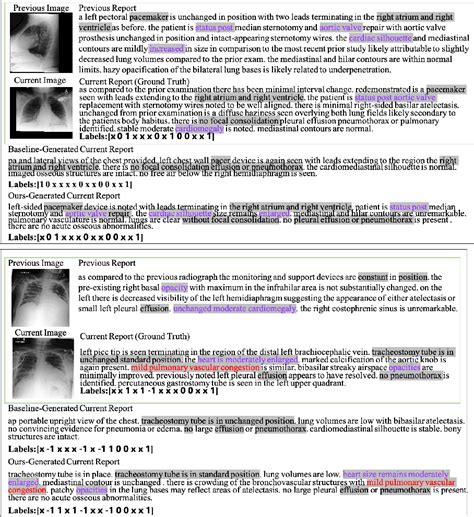 Figure 2 From Utilizing Longitudinal Chest X Rays And Reports To Pre Fill Radiology Reports