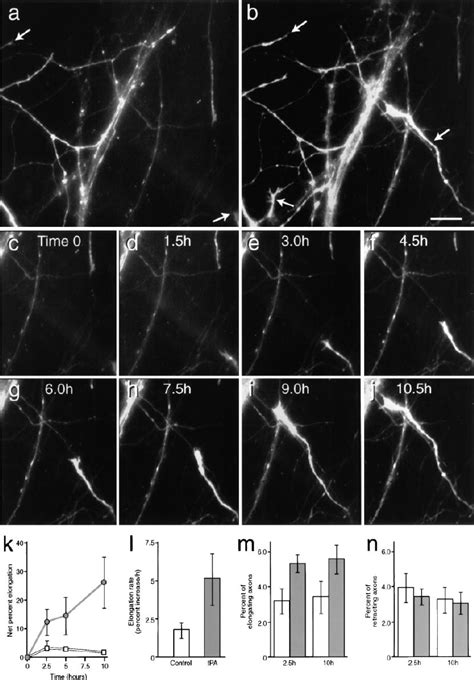 Tpa Induced Axonal Elongation Dentate Gyrus Granule Cells Were Download Scientific Diagram