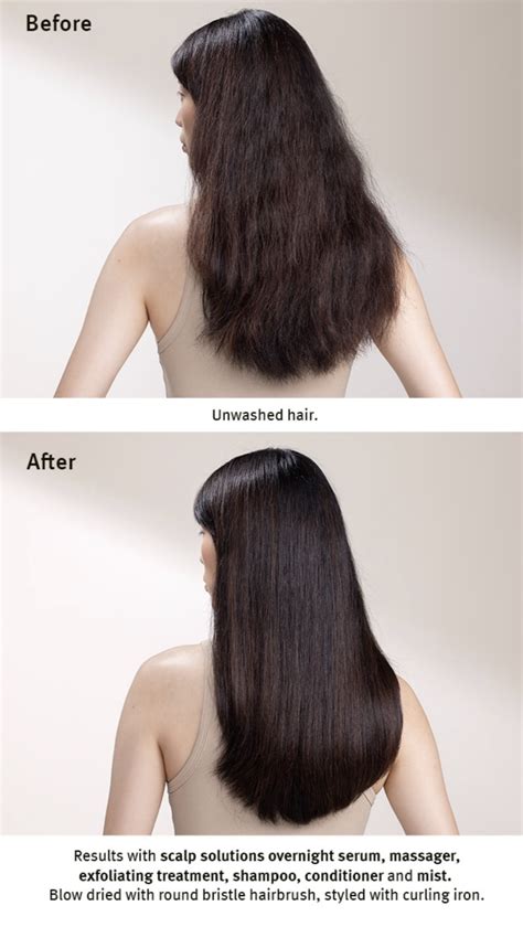 Scalp Solutions Exfoliating Scalp Treatment Salon