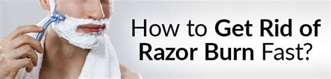How To Get Rid Of Razor Burn Fast Ways To Prevent And Treat Razor Burn Video