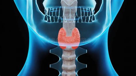 Nodular Goiter Occurs When The Thyroid Gland Does Not Produce Enough