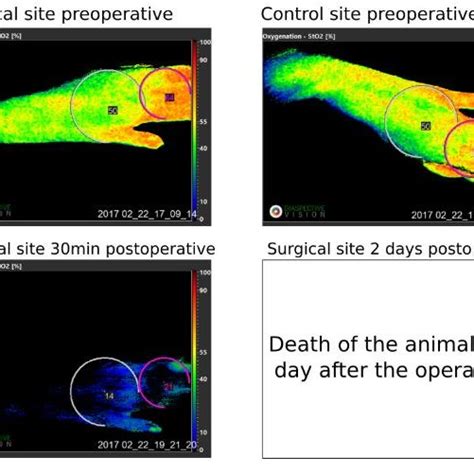 Rutherfords Classification Of Acute Limb Ischemia Download Table