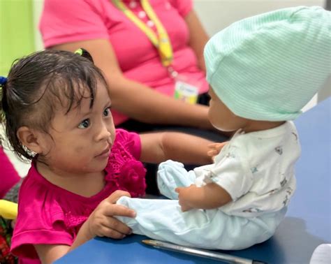 Much More Than A Toy Cleft Dolls Build Confidence Hope And Life