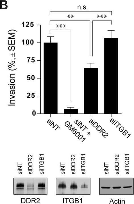 Human Ddr2 Antibody Af2538 Randd Systems