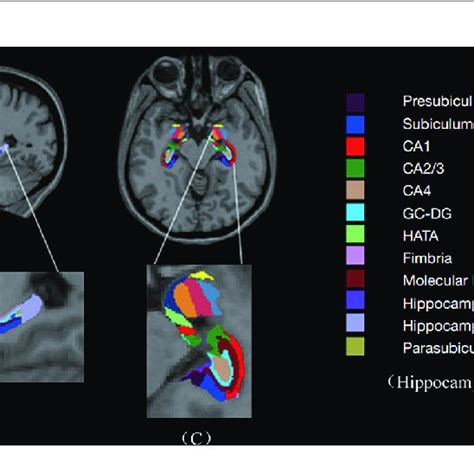 Subregions Of Hippocampus And Amygdala Columns A C Represent The