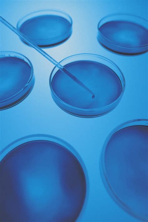 How To Grow Bacillus Subtilis Ehow